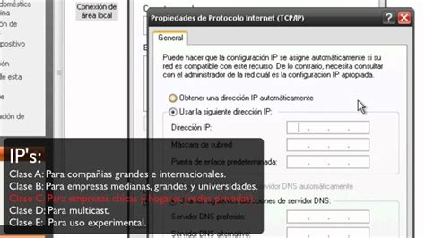 Cómo configurar direccion ip en windows xp Mundowin