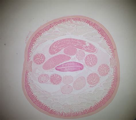 Ascaris Lumbricoides Male Cross Section Parasitology
