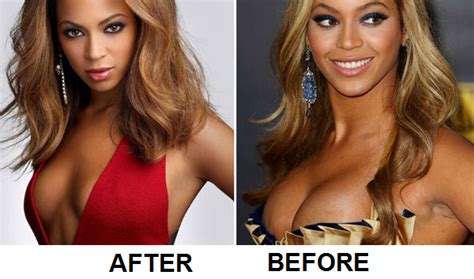 Pin On CelebrityNoseJobs Net