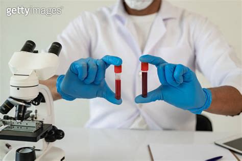 Asian Hematologist Examines Medically Necessary Blood Tests Ordered By