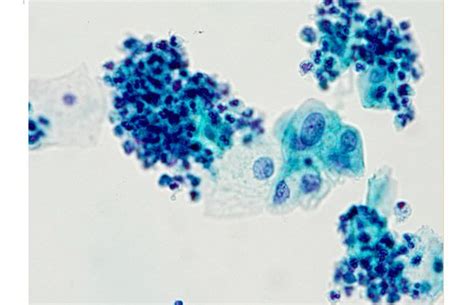 Cytology Meaning