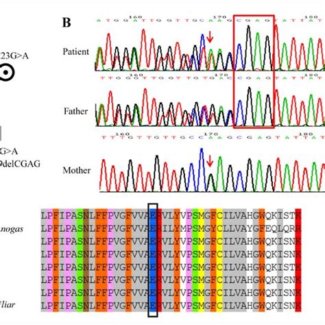 Genetic Sequencing Of The Patient A Pedigree Of The Patient B