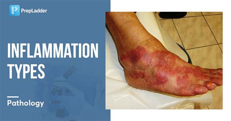 Inflammation Types NEET PG Pathology