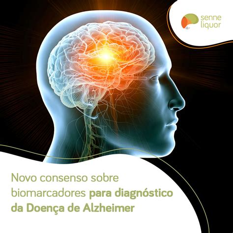 Novo consenso sobre biomarcadores para diagnóstico da Doença de