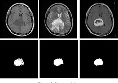 figure 3 from brain tumors classification using convolutional neural networks semantic scholar
