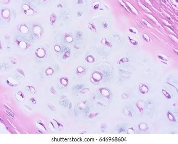 Histology Human Trachea Tissue Show Cartilage Stock Photo 646968604
