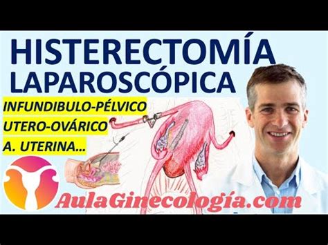 Histerectom A Laparosc Pica T Cnica Quir Rgica Paso A Paso