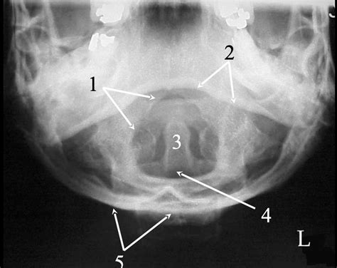 Fuch Judd C Spine Diagram Quizlet