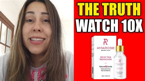 WARNING Amarose Skin Tag Remover Review THE TRUTH Does Amarose Skin
