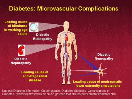 Pathways Leading To Diabetic Microvascular Complications And The Latest