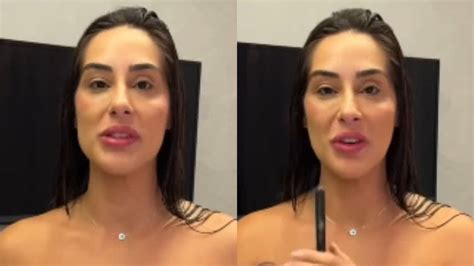Ex Bbb Deniziane Comemora Resultado De Pl Stica Radical A Bicha Est
