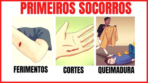 PRIMEIROS SOCORROS PARA FERIMENTOS CORTES E QUEIMADURAS YouTube