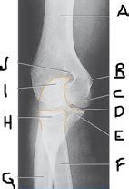 Procedures Test Forearm Elbow Humerus Flashcards Quizlet