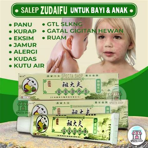 Jual Salep Zudaifu Bayi Anak Obat Gatal Balita Alergi Jamur Panu