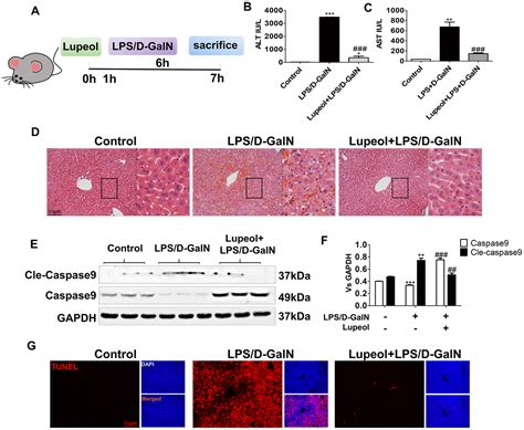Lupeol Ameliorates LPS D GalN Induced Acute Hepatic Damage By