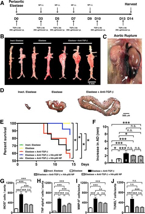 p5RHH p50 siRNA NP in TGF β blockade model of abdominal aortic aneurysm