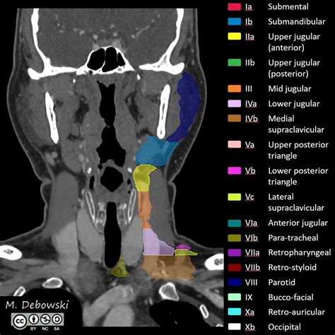 Cervical Lymph Nodes Radiopaedia Images And Photos Finder