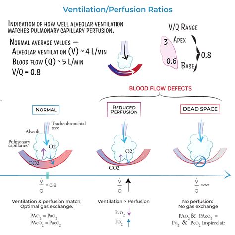 Physiology Glossary Ventilation Perfusion Ratios V Q Defects Ditki