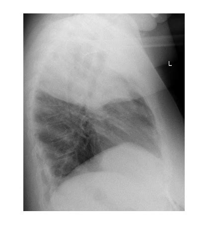Imaging Case Of The Week Emergucate