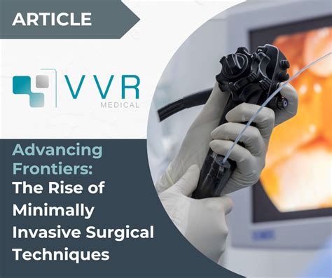 Advancing Frontiers The Rise Of Minimally Invasive Surgical Techniques