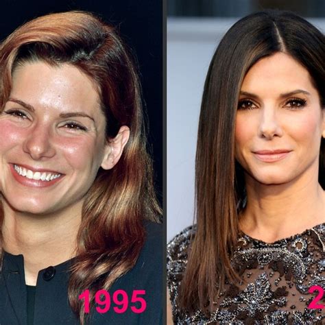 Sandra Bullock Et La Chirurgie Esth Tique Son Avant Apr S En Photos