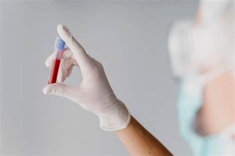 Leucemia o que é tipos sintomas e dúvidas comuns