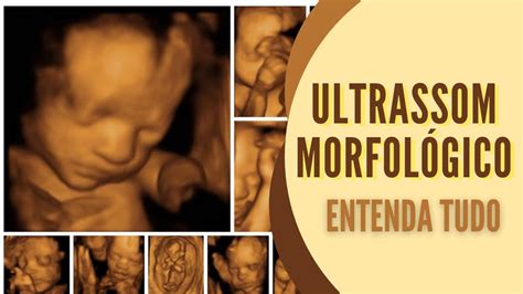 ULTRASSOM MORFOLÓGICO O que é Quando fazer Como é feito Onde Fazer
