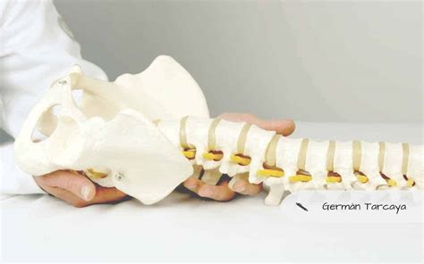 Hernia Discal S Ntomas Causas Y Tratamiento Fisioterapia Para