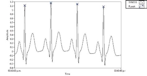 6 detection of r peak with a synthetized ecg signal download scientific diagram