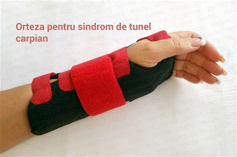 Sindromul De Tunel Carpian Simptome Cauze Tratament