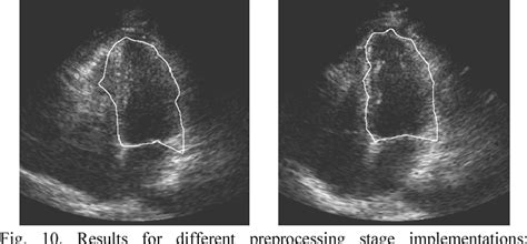 figure 10 from improved segmentation of echocardiographic images using fusion of images from