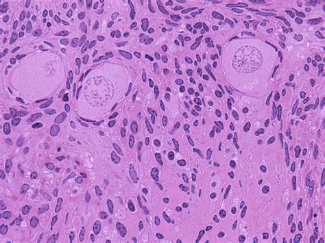 Primordial Follicles