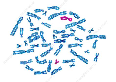 Human Karyotype Stock Image C012 9580 Science Photo Library