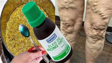 EU Tinha Vergonha De USAR SHORT E MINHAS PERNAS ESTAVAM Cheias De