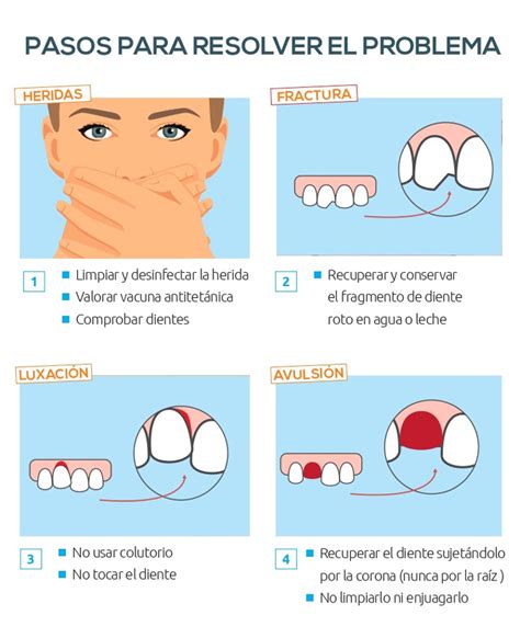 Qué hacer si se me rompe un diente Gaceta Dental