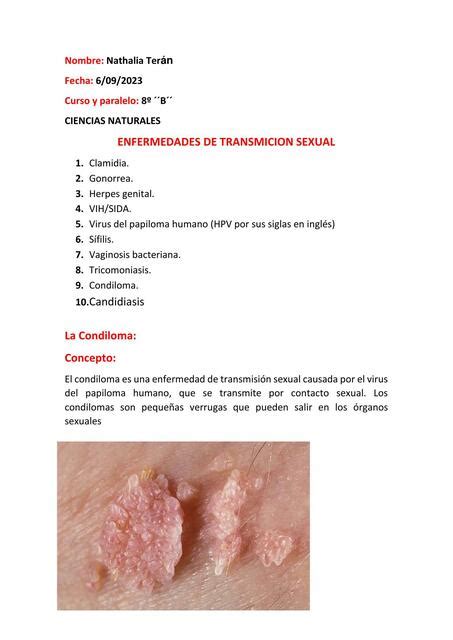 Enfermedades de Transmisión Sexual Maria uDocz