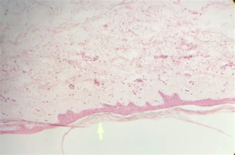 Histo Lab Cumulative Review Flashcards Quizlet