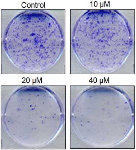 Colony Formation Assay Of The Zingiberene Treated HT 29 Cells At