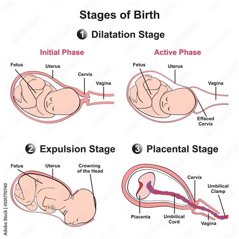 Plakat Stages Of Baby Birth Infographic Diagram Onset Of Labour Flexion