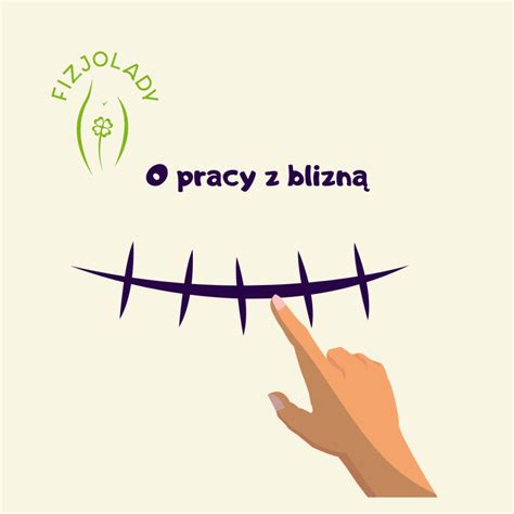 Jak Pracowa Z Blizn Po Cesarskim Ci Ciu Fizjolady