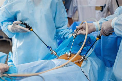 Laparoscopic Robotic Surgery UNC REX Colorectal Surgery