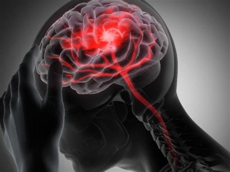 Niño se cae en el recreo y queda con daño cerebral qué hacer en caso