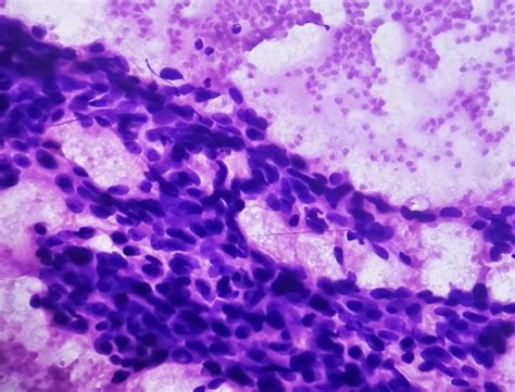 Infosalus Desarrollan Un M Todo R Pido Y Preciso Para Detectar