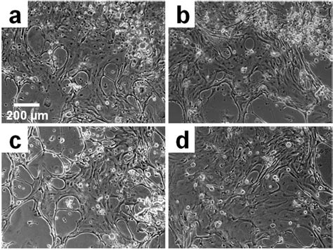 Growth Of Primary Human Corneal Limbal Epithelial HLE Cells After