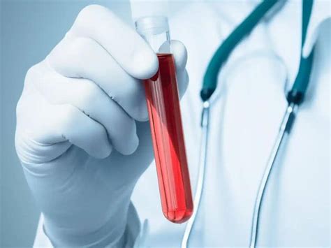 Biopsia Líquida Cuáles son sus ventajas