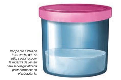 Sabes cuál es el volumen color y aspecto normal de un seminograma