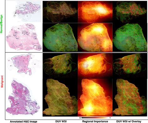 Frontiers Deep Learning Classification Of Deep Ultraviolet