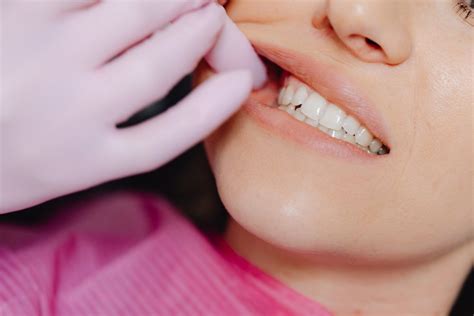 Pulpitis qué es tipos principales síntomas y tratamiento
