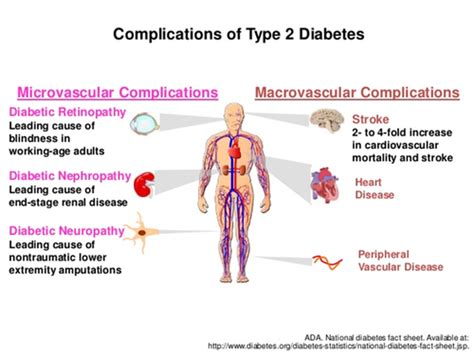 Complications Of Diabetes Flashcards Quizlet