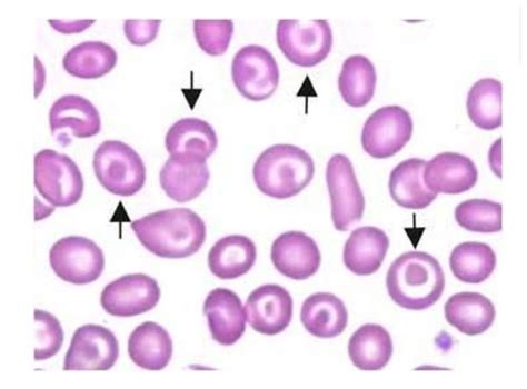 Morphology Of Rbc Wbc Plt Flashcards Quizlet